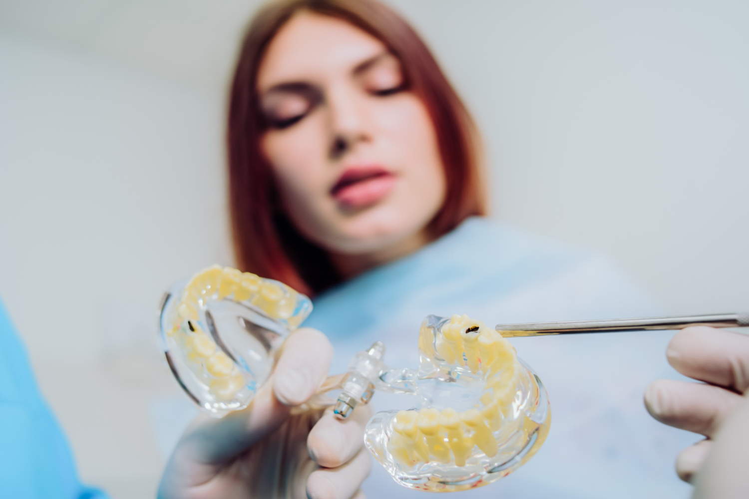 What Does A Cavity Look Like Gentle Dentistry